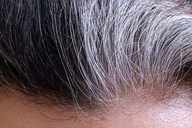 What Causes White Hair? - PsychologyTodayArticles