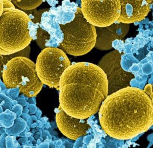 Jual Bakteri Staphylococcus epidermidis ~ Microbio-Lab