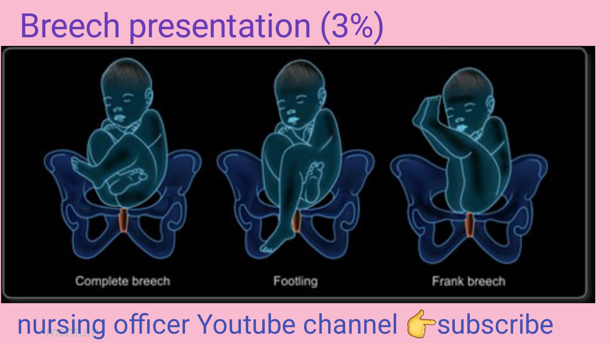 fetal lie attitude presentation position | Mr SHYAM