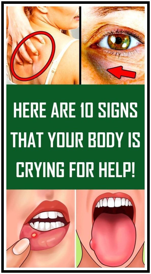 Here Are 10 Signs That Your Body Is Crying For Help!