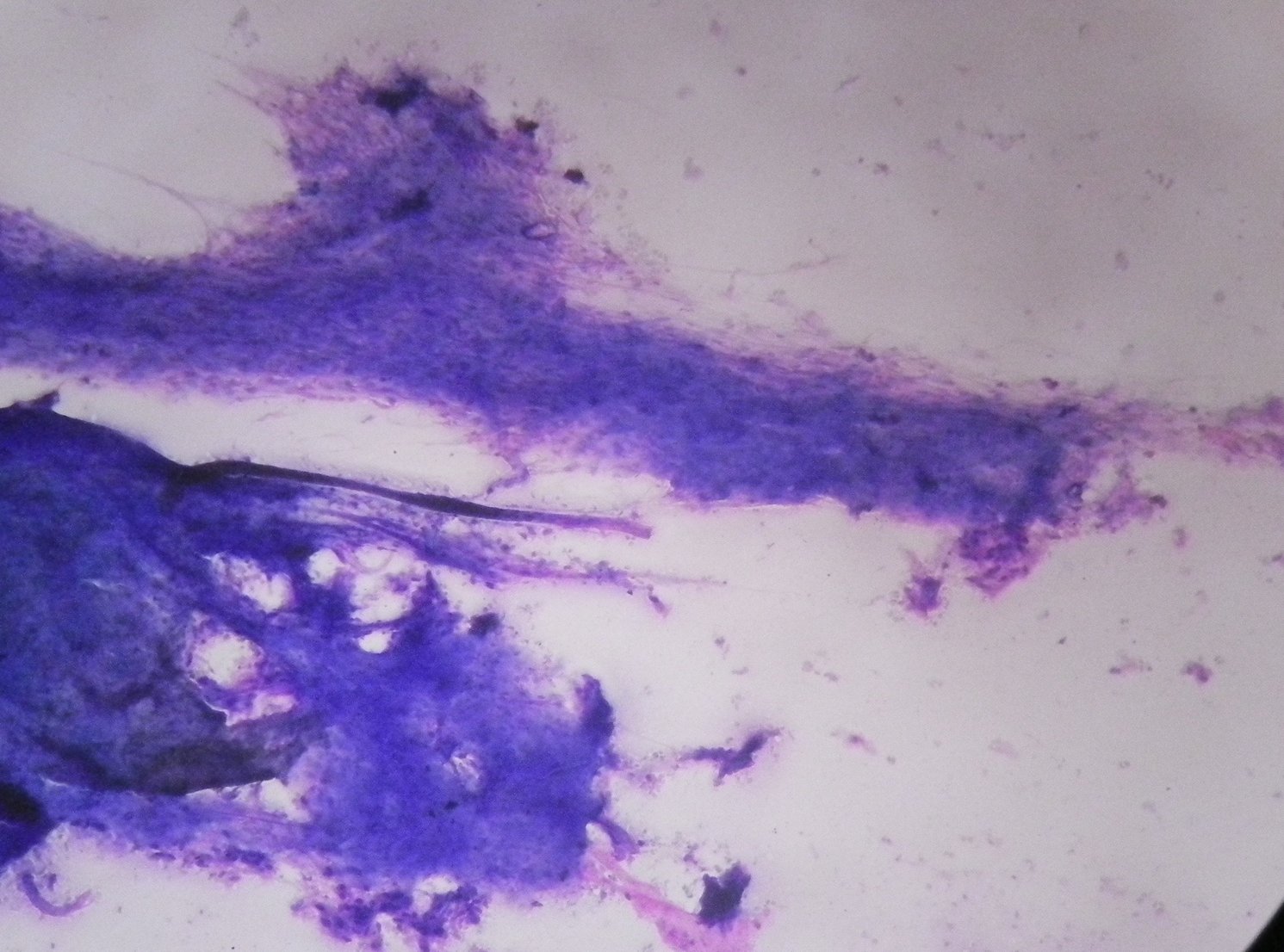 into the roots: Lung cytology