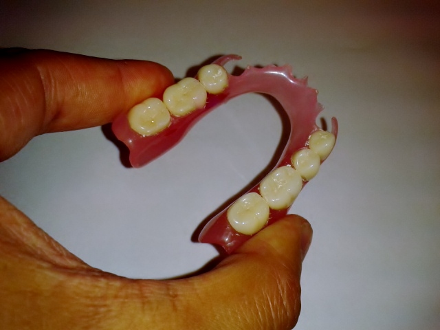 Prótesis dentales: Prótesis flexibles TCS Iflex o Partial Flex