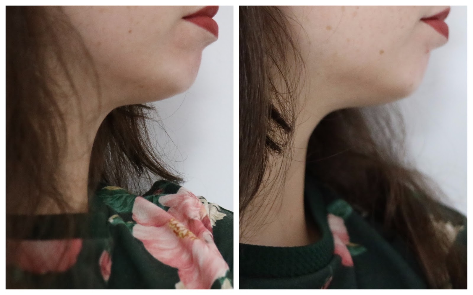 Sem queixo duplo em 30 minutos by ChinUp | Delta Ferreira