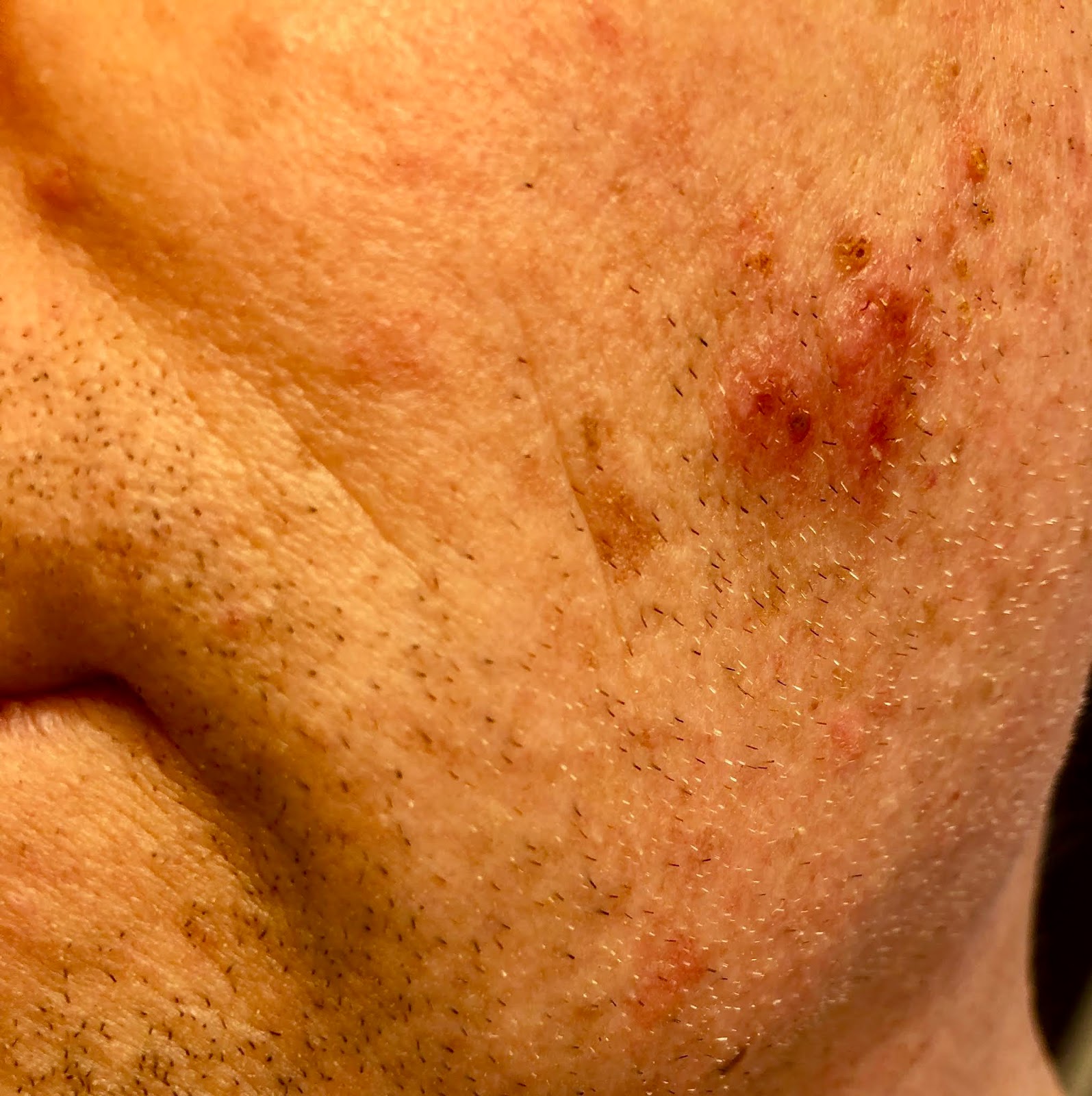 Black Salve Info: October 2019