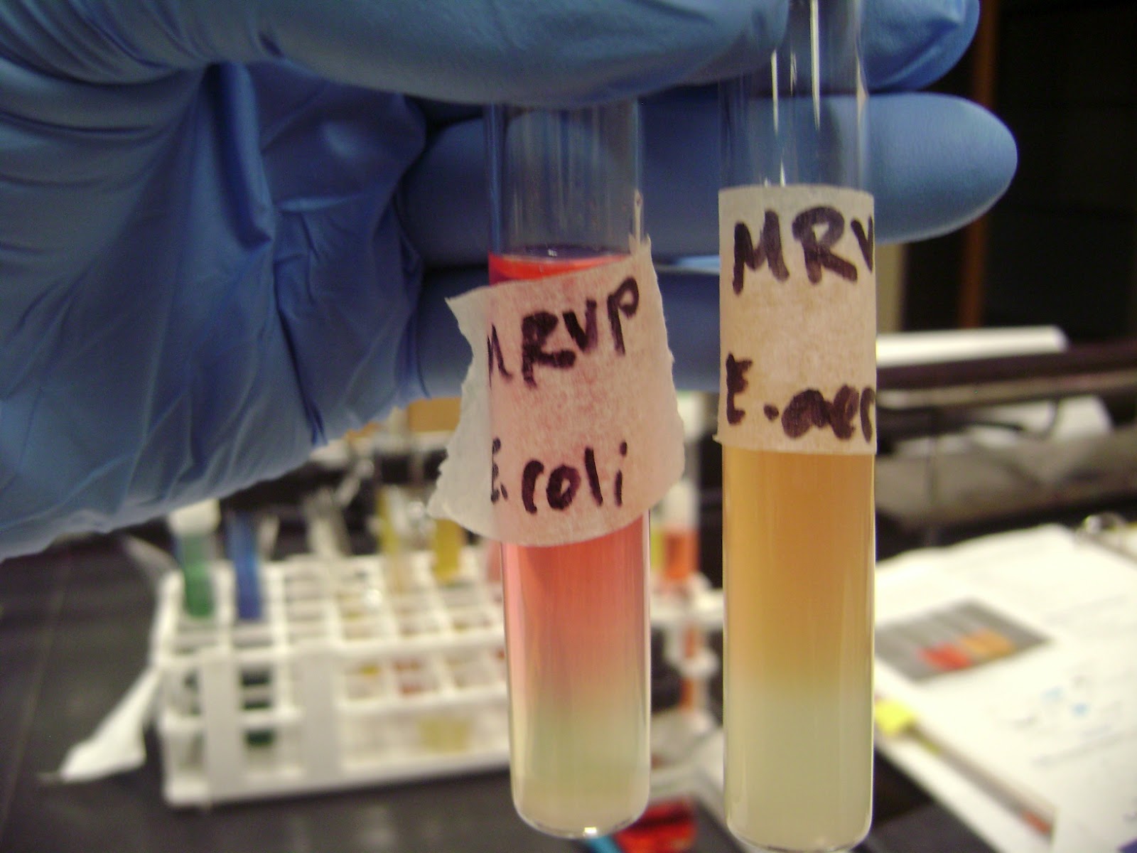 Bio E.journal: Methyl Red & Voges Proskauer Test