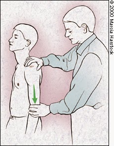 Shoulder / ПЛЕЧИ: The Painful Shoulder: Part I. Clinical Evaluation