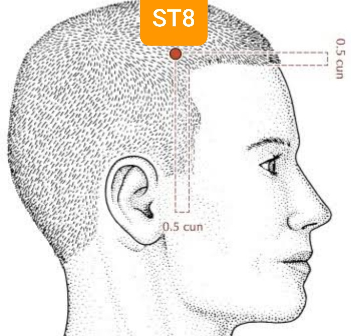 Acuworld: ACUPRESSURE POINTS FOR HEADACHE