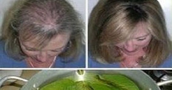 Guava Leaves Can Extremely 100 Stop Your Hair Loss And Make It Grow