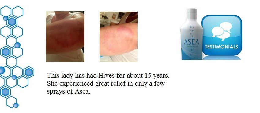 The Redox Molecule Advantage: Learn The New Super Healing Spray From ...