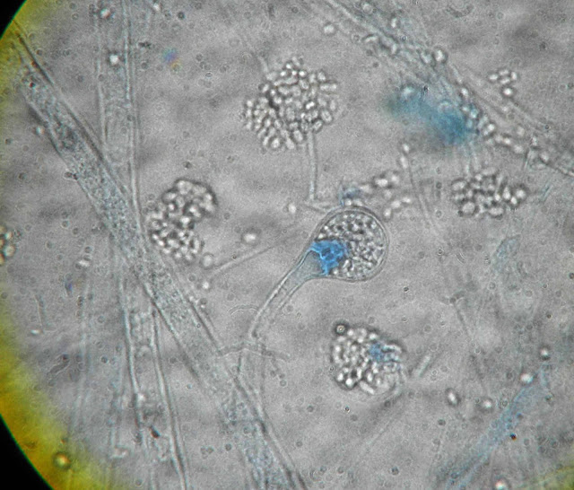 ATLAS MICOLOGIA: ABSIDIA CORYMBIFERA / Lichtheimia corymbifera