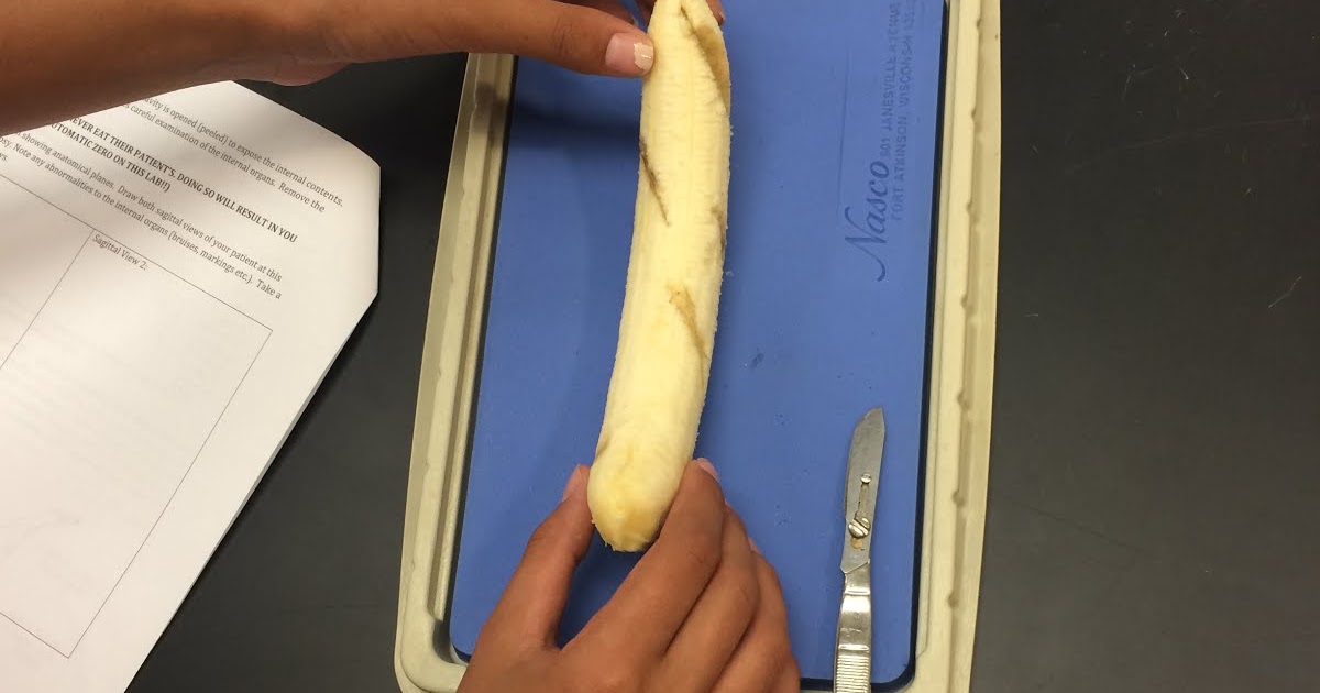 Maxine Parr's Anatomy and Physiology Blog: The Crime Investigation of ...