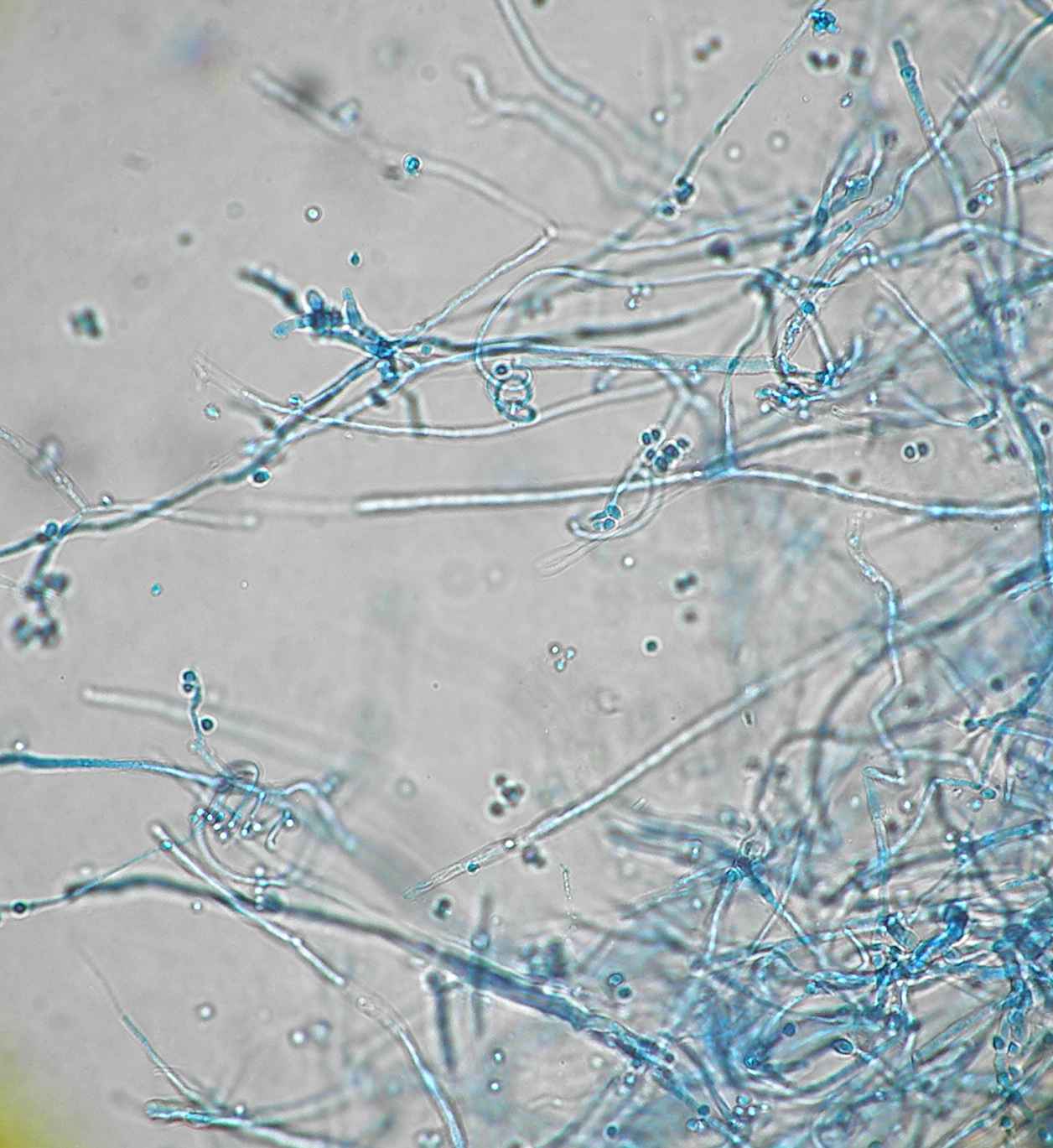 ATLAS MICOLOGIA: TRICHOPHYTON INTERDIGITALE