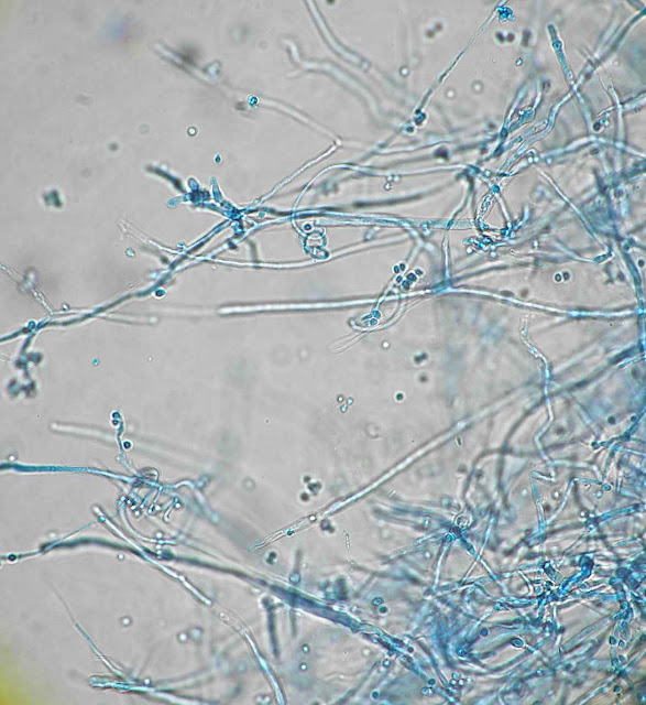 ATLAS MICOLOGIA: TRICHOPHYTON INTERDIGITALE