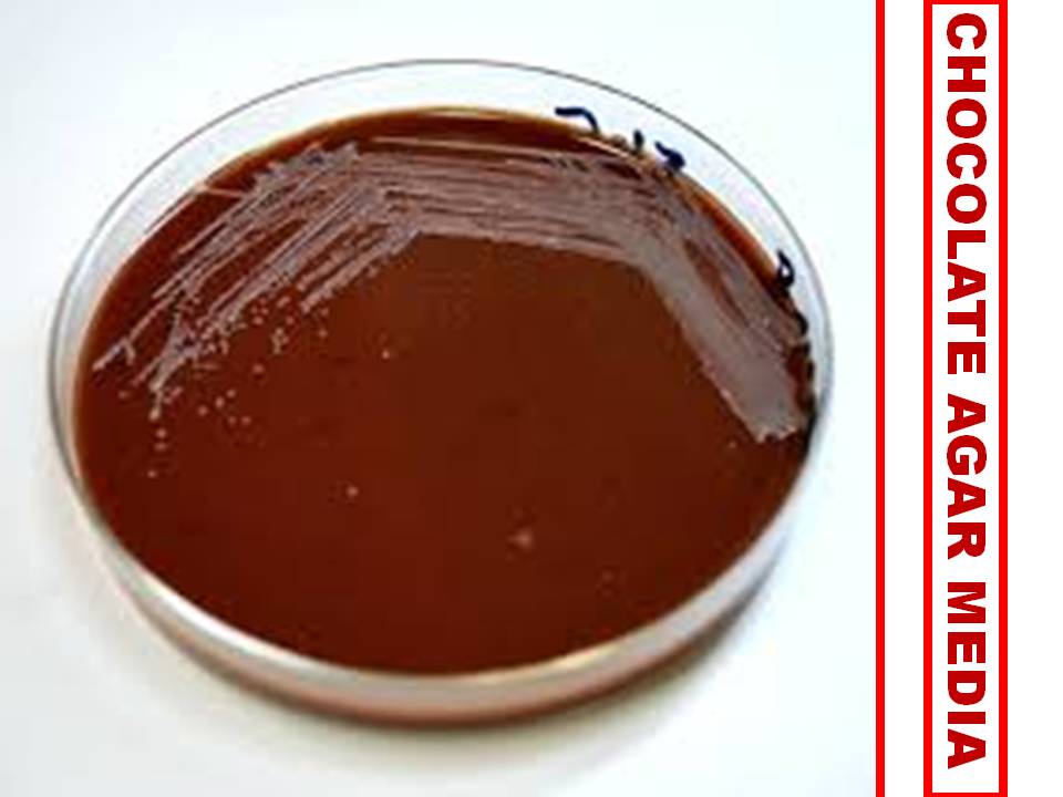 TYPES OF CULTURE MEDIA IN MICROBIOLOGY