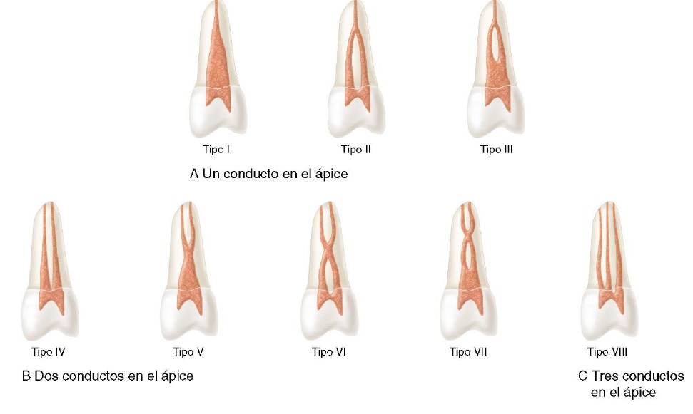 Endodoncia: técnica y fundamentos: Imagen: representación esquemática ...