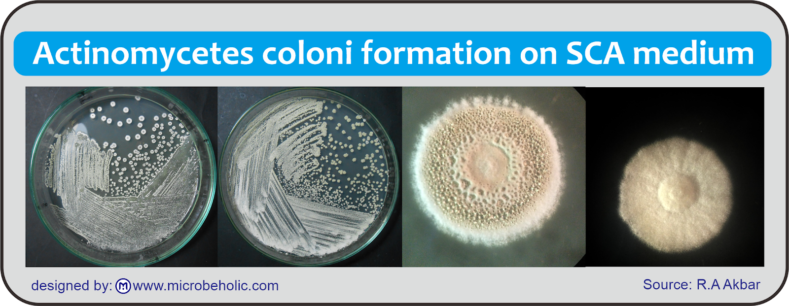 Starch Casein Agar (SCA) - Definisi, Komposisi, Cara Pembuatan dan ...