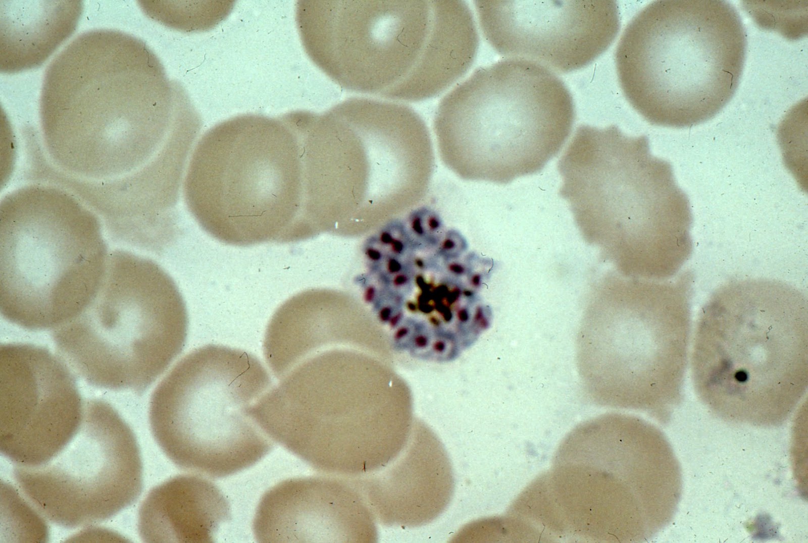 Plasmodium vivax (Indonasia version) | CocoQuiin’s Blog