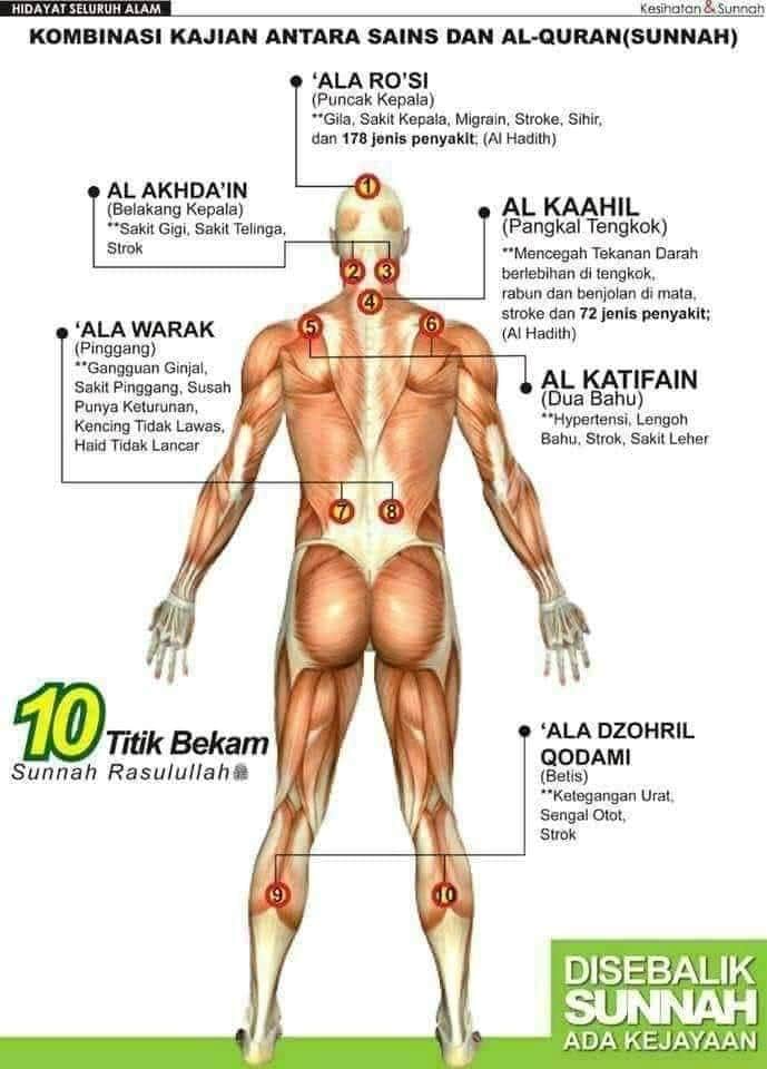 10 Titik Bekam Sunnah Rasulullahu 'Alaihi Wassalam - Belajar Bekam Mandiri