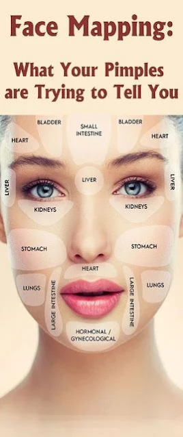 Face Mapping: What Your Pimples Are Trying To Tell You - Healthy Lifestyle