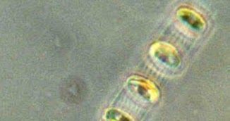 Skeletonema Costatum Adalah; Klasifikasi, Morfologi, Habitat Dll ...