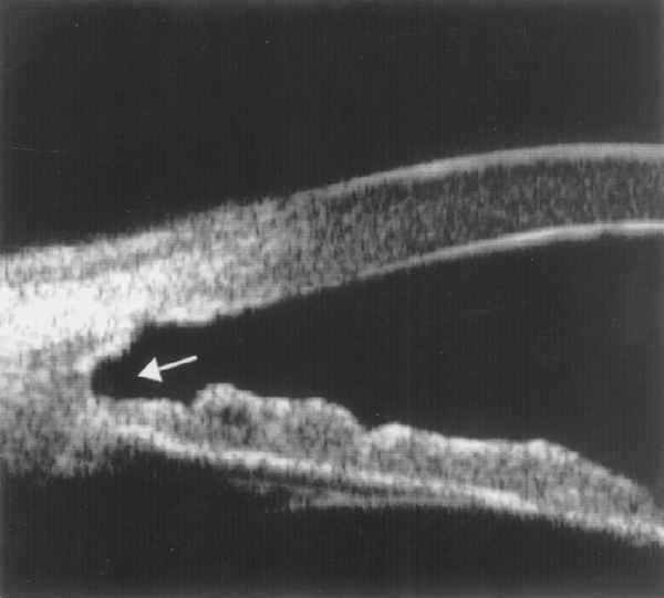 GLAUCOMA SPECIALIST BLOG: "THE GLOG"