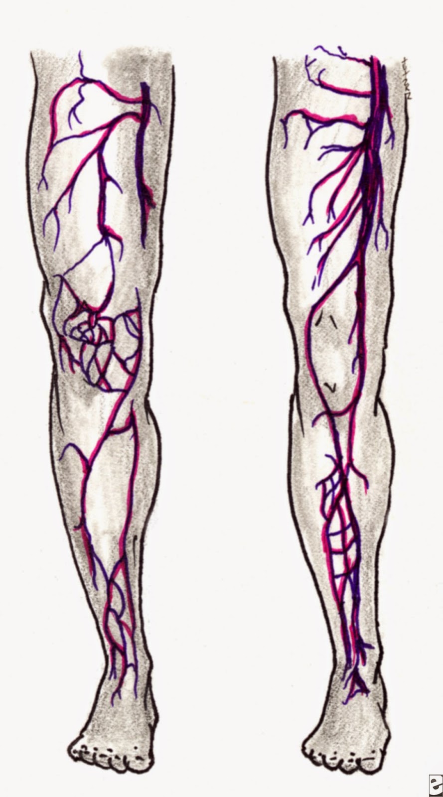 Caso 42: Tromboflebitis séptica sural por Streptococcus pyogenes – Guía ...