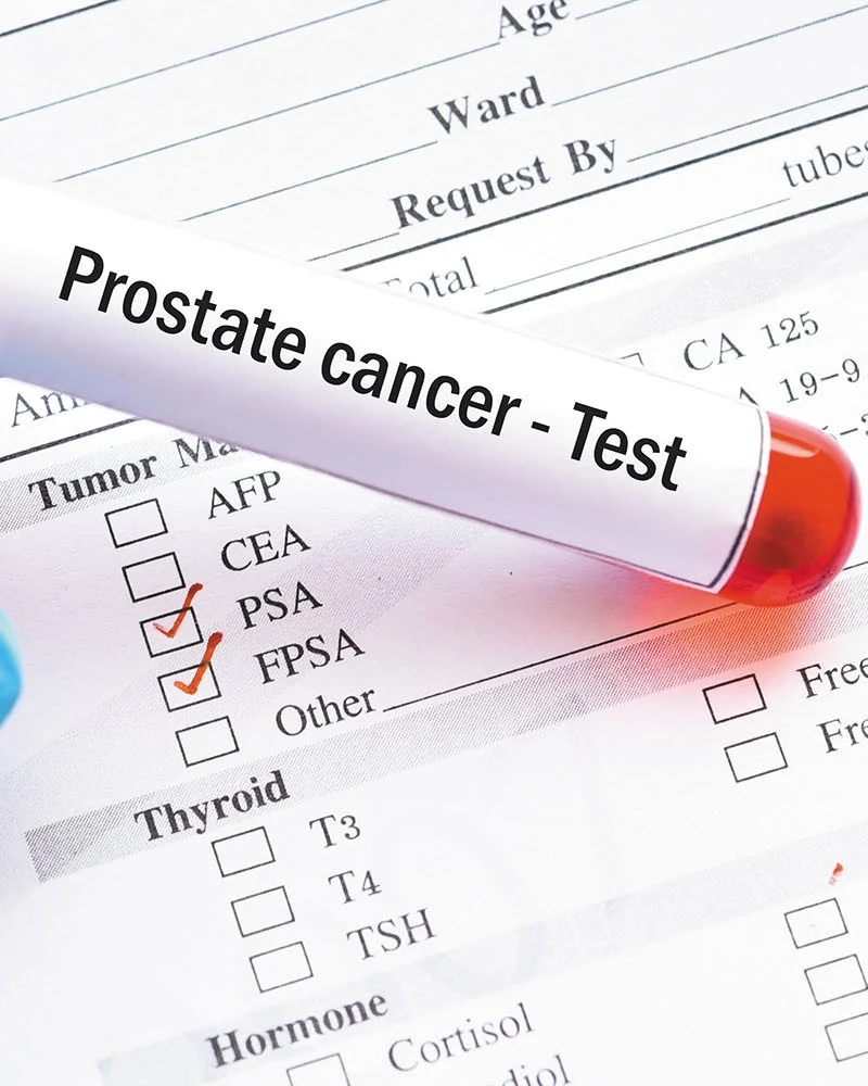 New Prostate Cancer Testing Methods | Melody Jacob