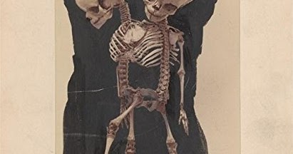 View Review Mutter Museum: Historic Medical Photographs PDF by Lindgren ...