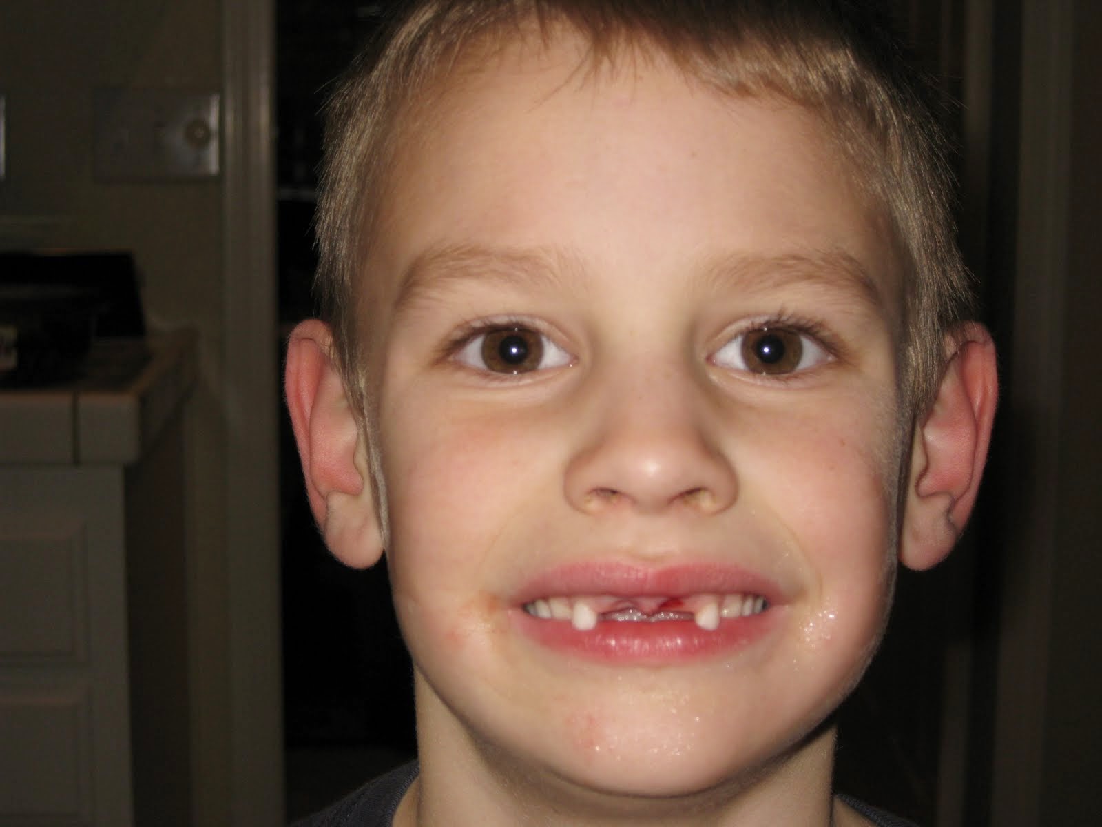 NATURAL HOME REMEDIES FOR SCURVY - Natural Fitness Tips ERROR 404 ...