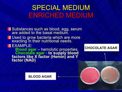 RDK PARAMEDICAL STUDENT STUDY: Difference Between Enriched Media and ...