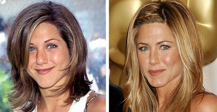 Jennifer Aniston Plastic Surgery
