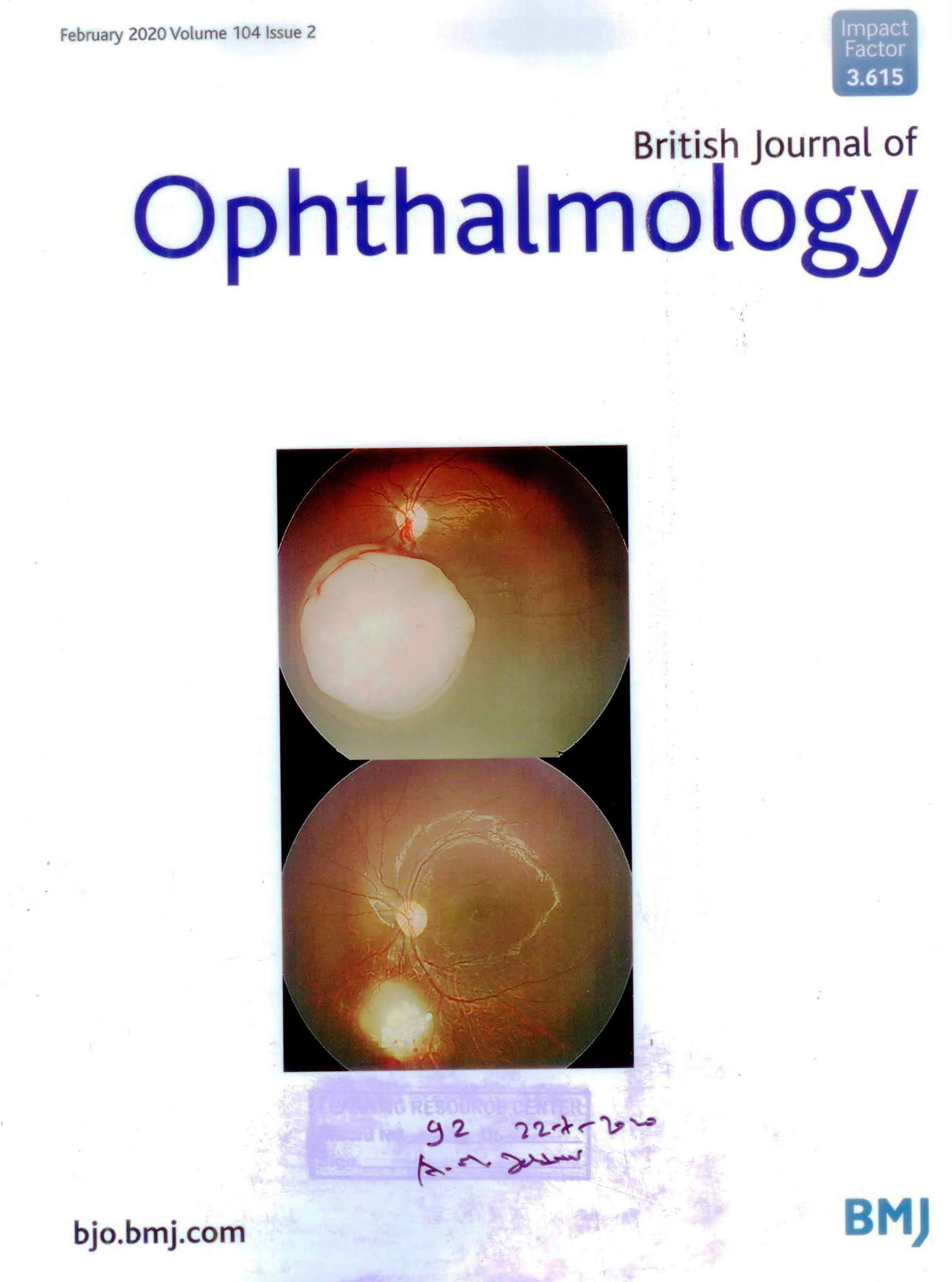 British Journal of Ophthalmology V 104 I 02 - LRC