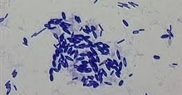Mengenal Bakteri Bacillus polymyxa - AGROTEKNO LAB