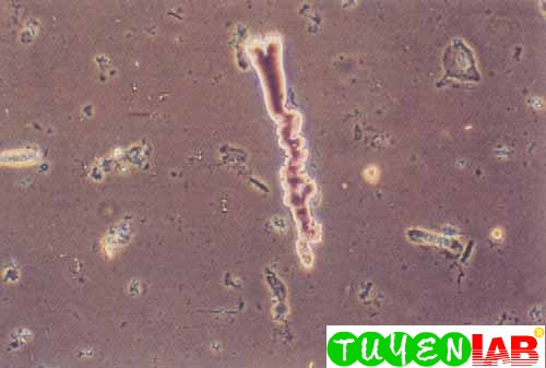 Atlas of Casts in urine | Free Medical Atlas