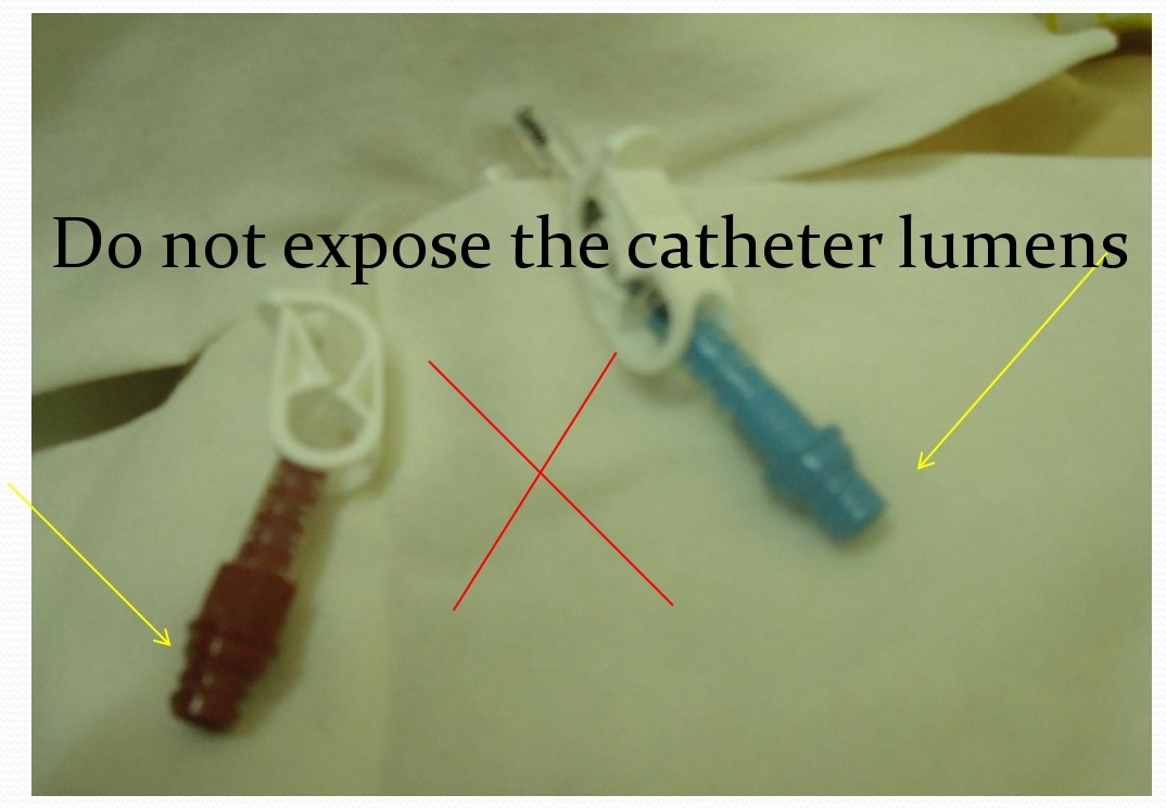 Protocols for Safe and Infection Free Dialysis Unit for Patients