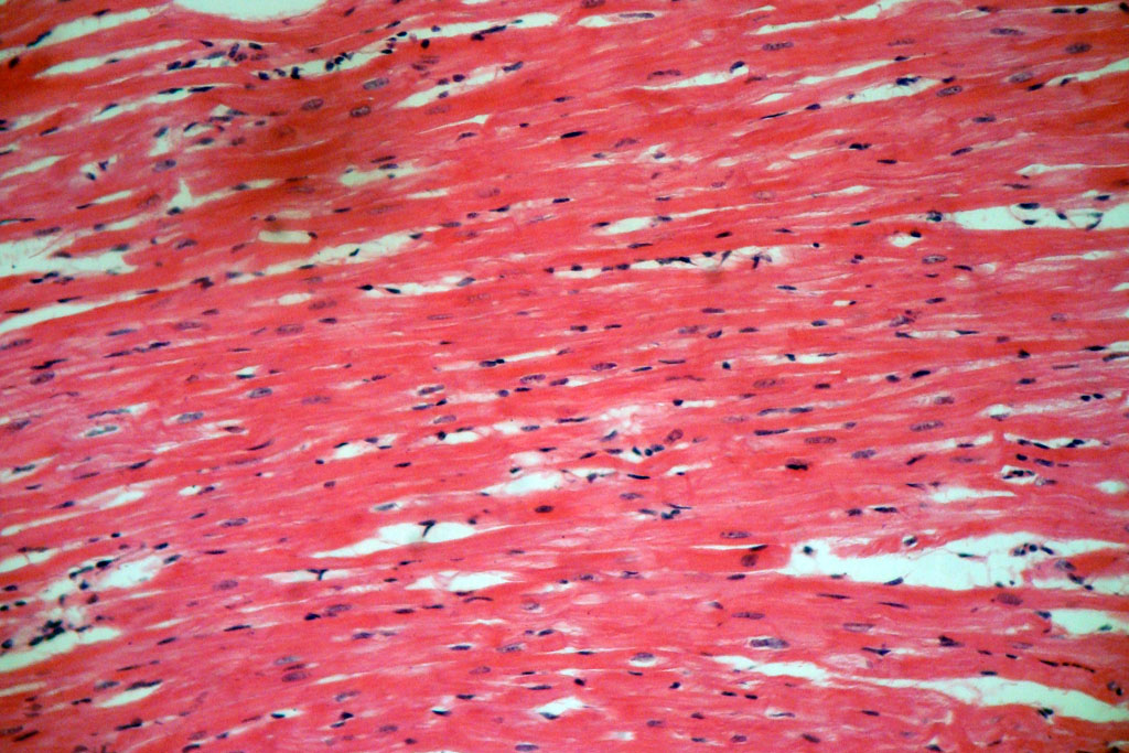 Prático e Básico: Tecidos III - Tecido Muscular