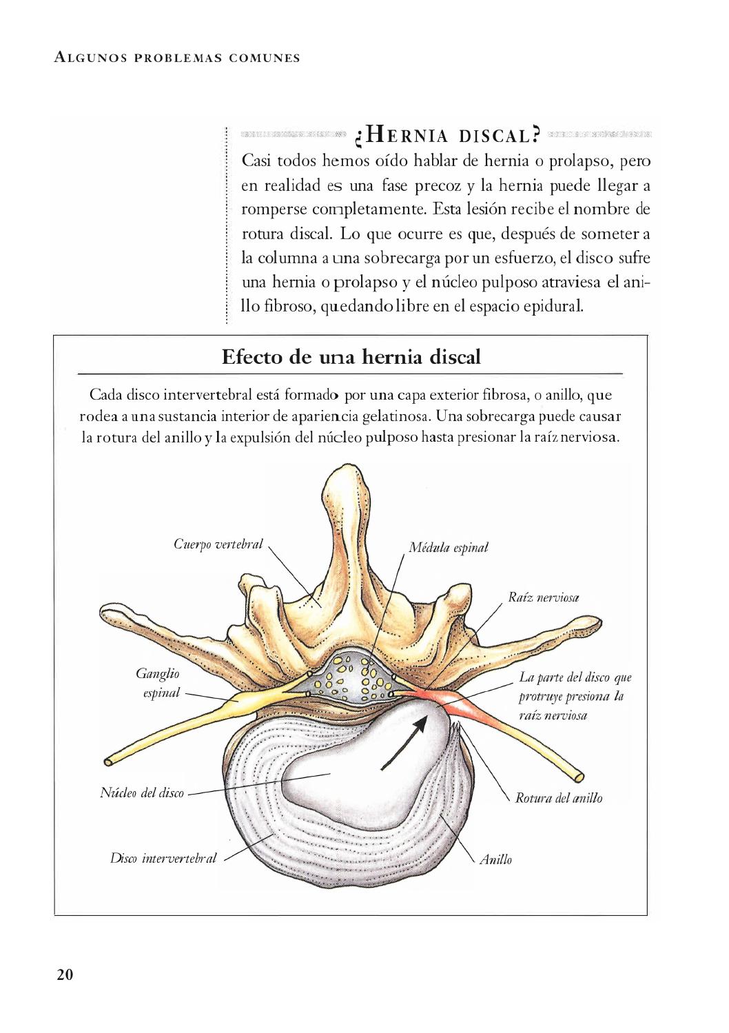 MyStretchingVital: ¿Qué es la Hiperflexibilidad? Hugo Cascia FUENTE ...