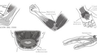 Enfermedades raras: Distonía focal