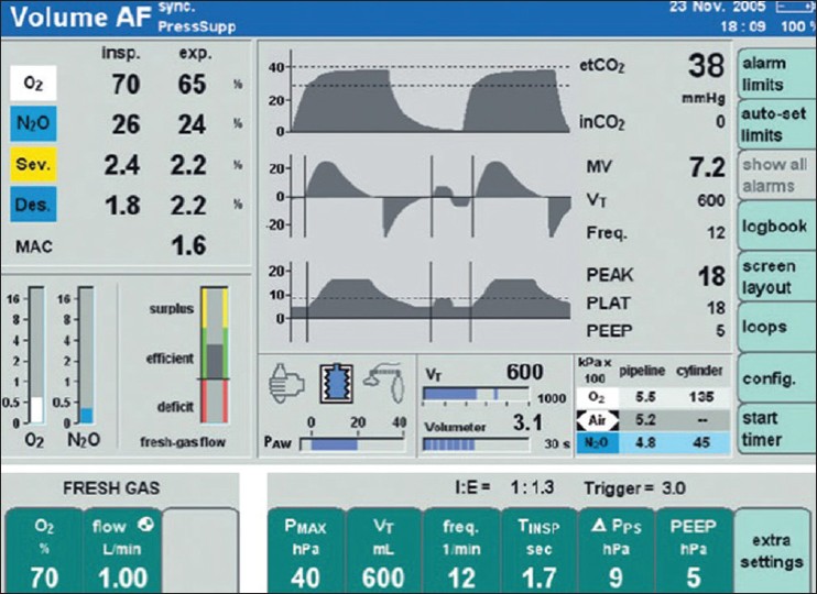 MV (MECHANICAL VENTILATOR) SETTINGS,MAKE EASY