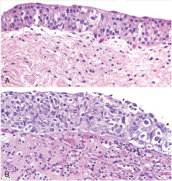 Médicos do Futuro: Urotélio