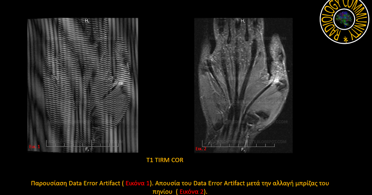 Radiology Community: Data Error Artifact