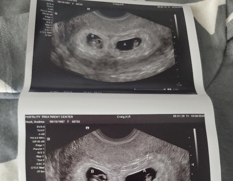 Us Hunts: 6 week 4 day Ultrasound