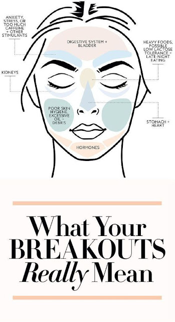 Here's What Those Breakouts on Your Face Really Mean | Healthy Optimum
