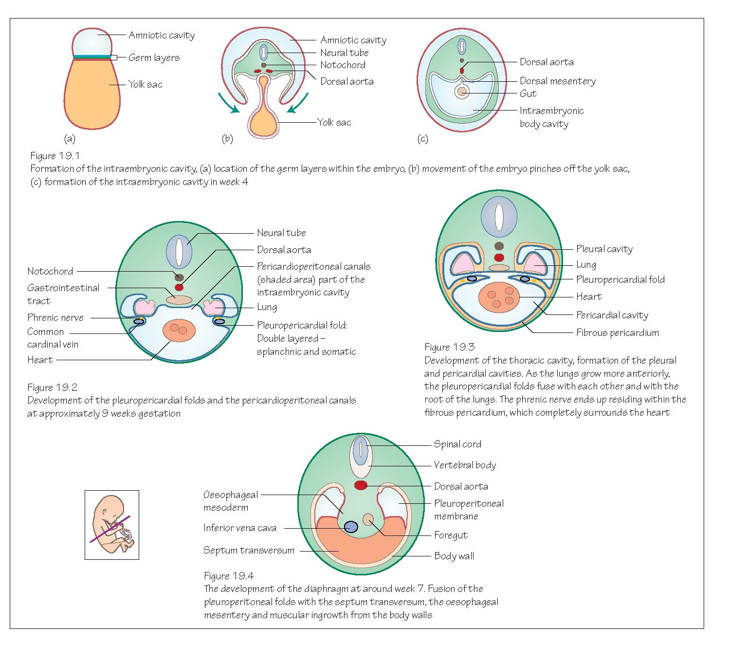 Body Cavities (Embryonic) - pediagenosis
