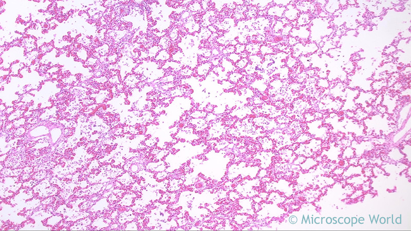 Microscope World Blog: Penumonia under the Microscope