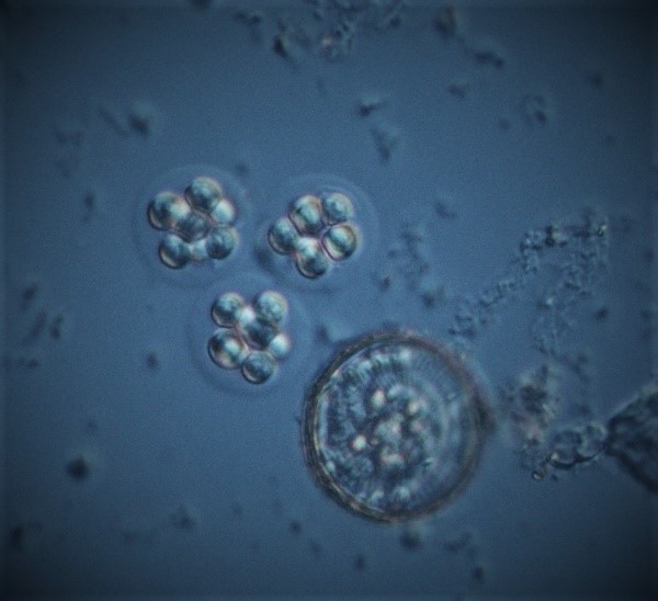 Blog Proyecto REMABAR.: La comunidad planctónica lacustre “El ...