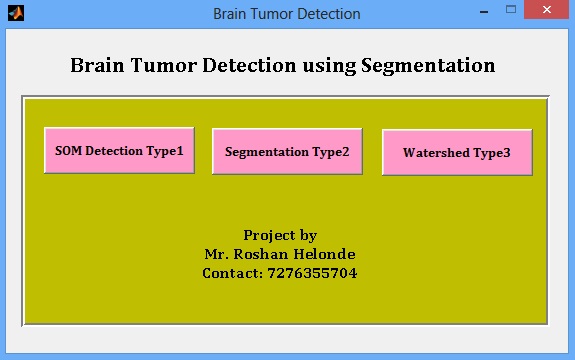 An Efficient Brain Tumor Detection Algorithm Using Watershed And Segmentation Methods ~ Matlab