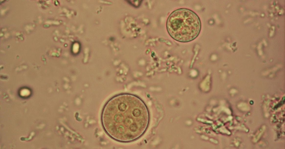 BIOLOGIA MOLECULAR: PRUEBA CONFIRMATORIA DE AMEBIASIS