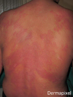 Dermapixel: marzo 2021