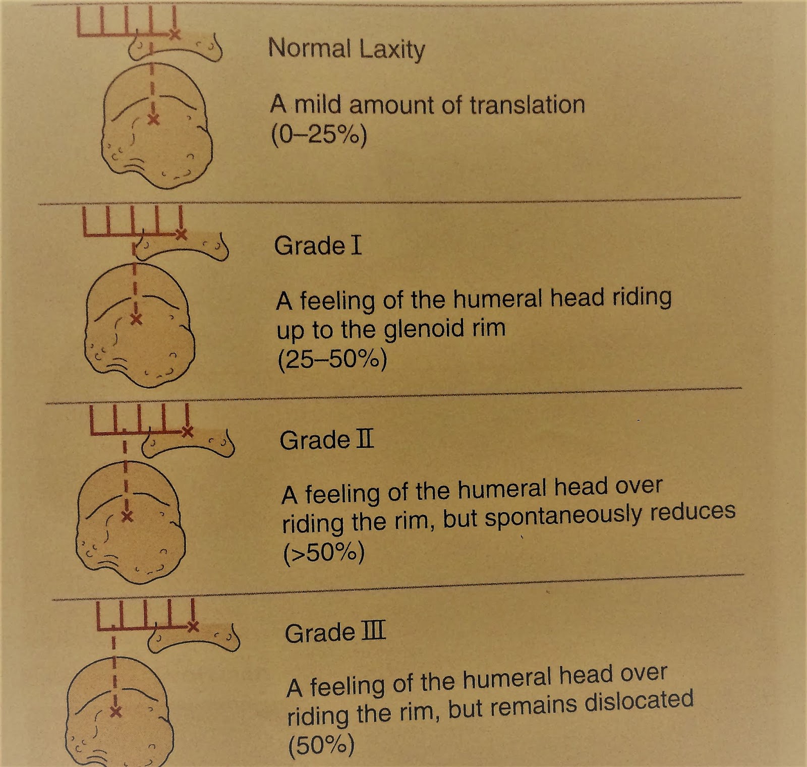 A Load and Shift Test | special Test